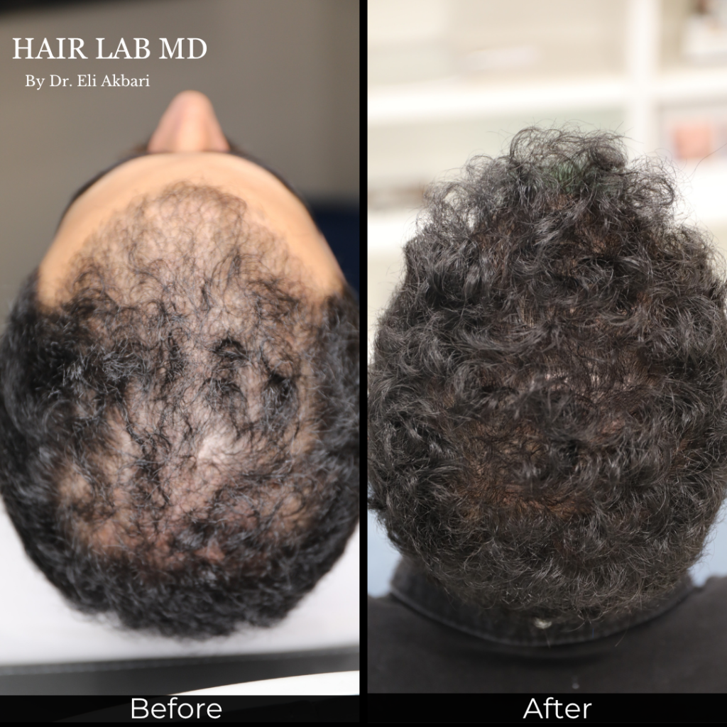 Monarch MD and Hair Lab MD - Vancouver